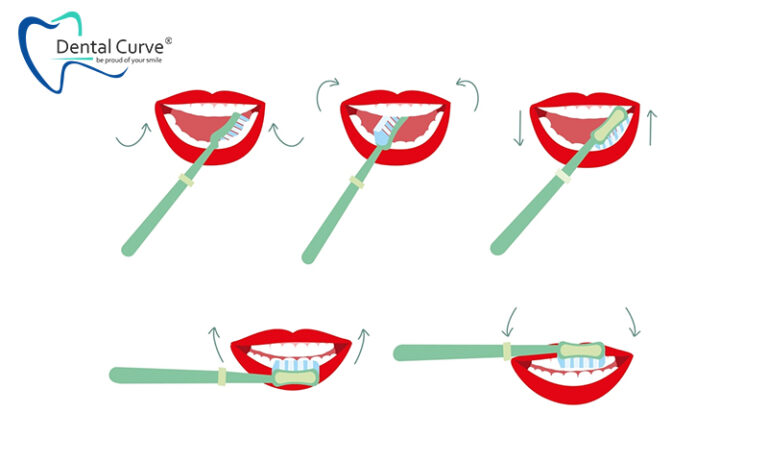 How Right Brushing Technique Improves Teeth Cleaning? | Dentalcurve